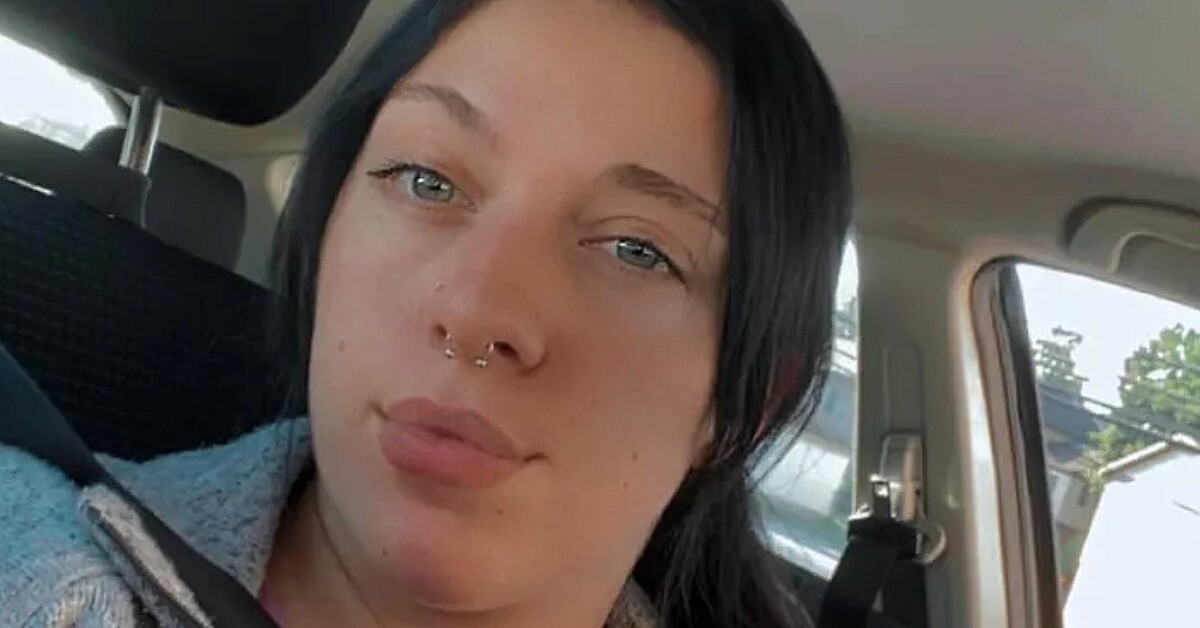 Jovencita pide ayuda para operarse: un pitbull le arrancó la nariz y le ...